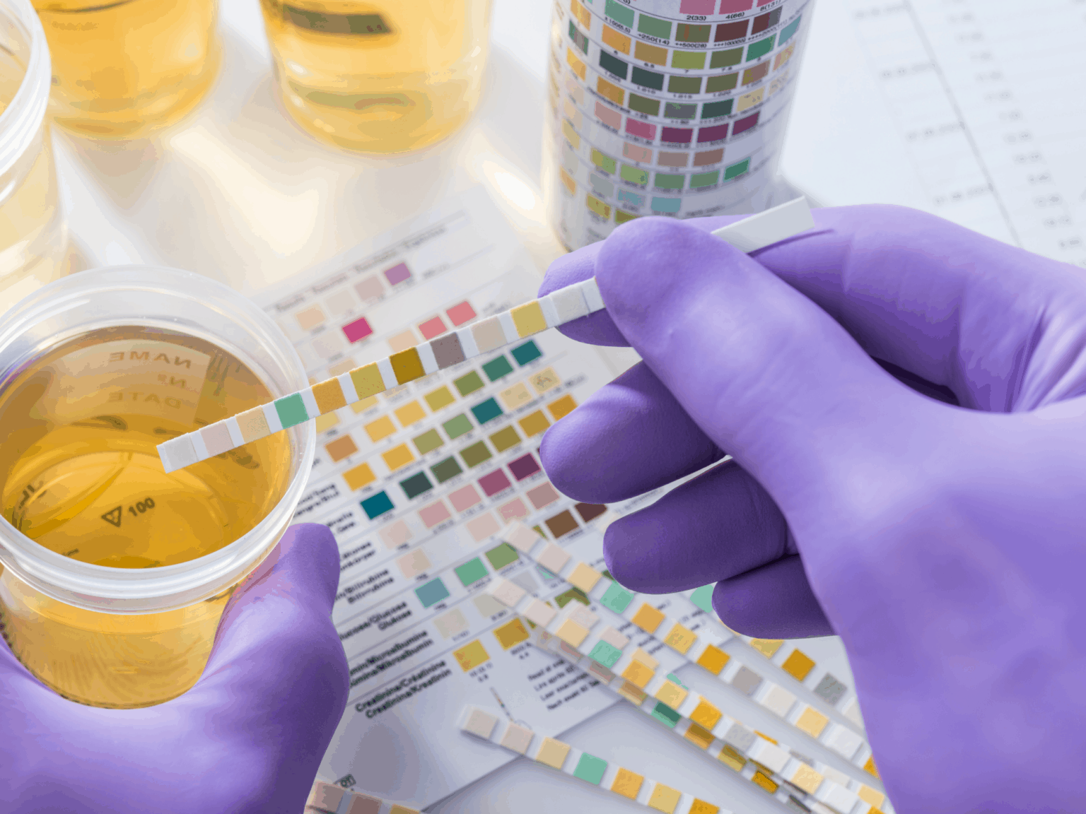 What Drugs Show Up in a Urine Test?